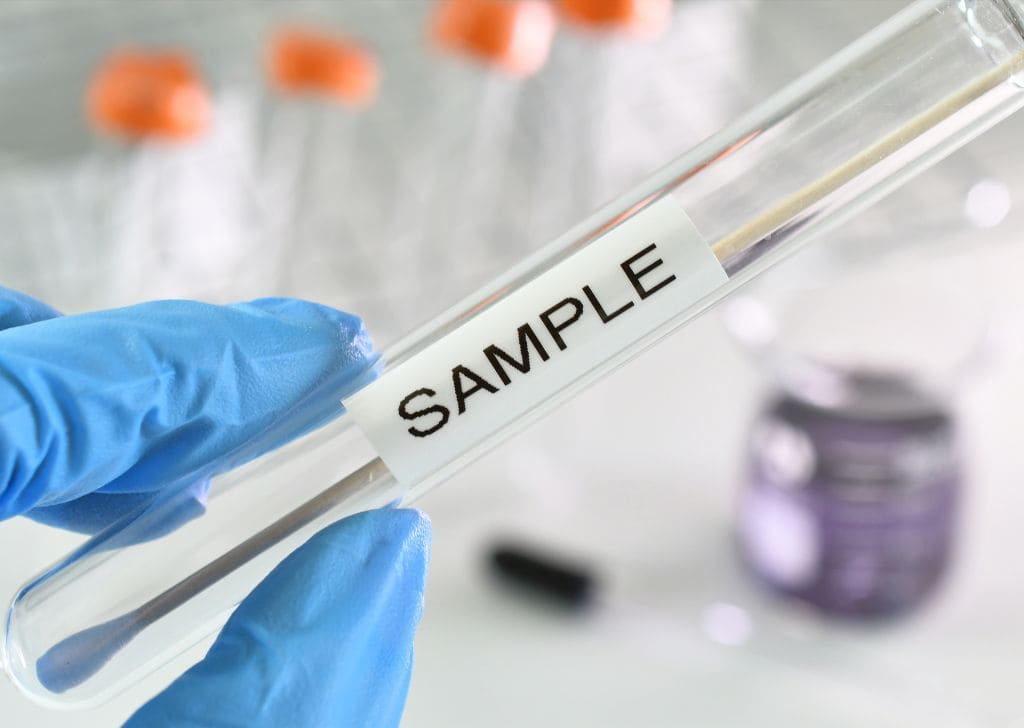 STD Testing Malaysia: Fast & Private | He Medical Clinic